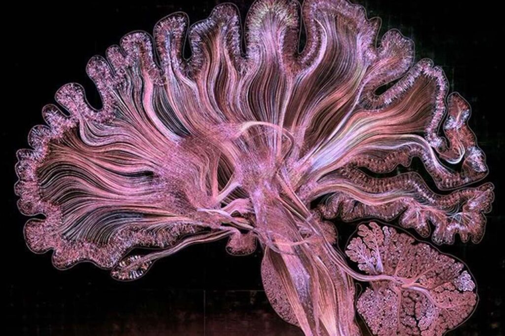 Maladaptive Daydreaming And Creativity In Adolescence: A Double-Edged ...